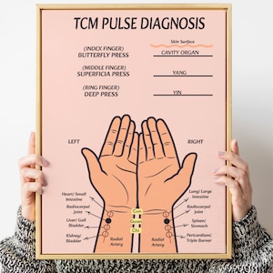 TCM Pulse Diagnosis Chart: Acupuncture Poster, Chinese Medicine Art ...