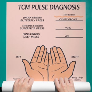 TCM Pulse Diagnosis Chart: Acupuncture Poster, Chinese Medicine Art ...