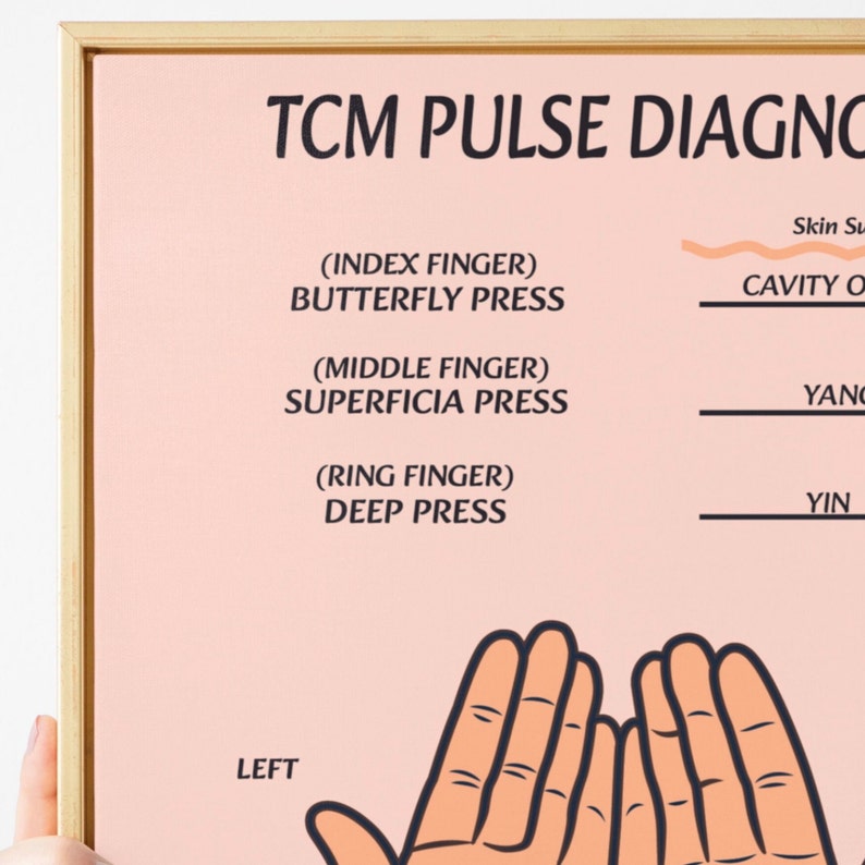 TCM Pulse Diagnosis Print, Pulse Chart Poster, Chinese Medicine Gift ...