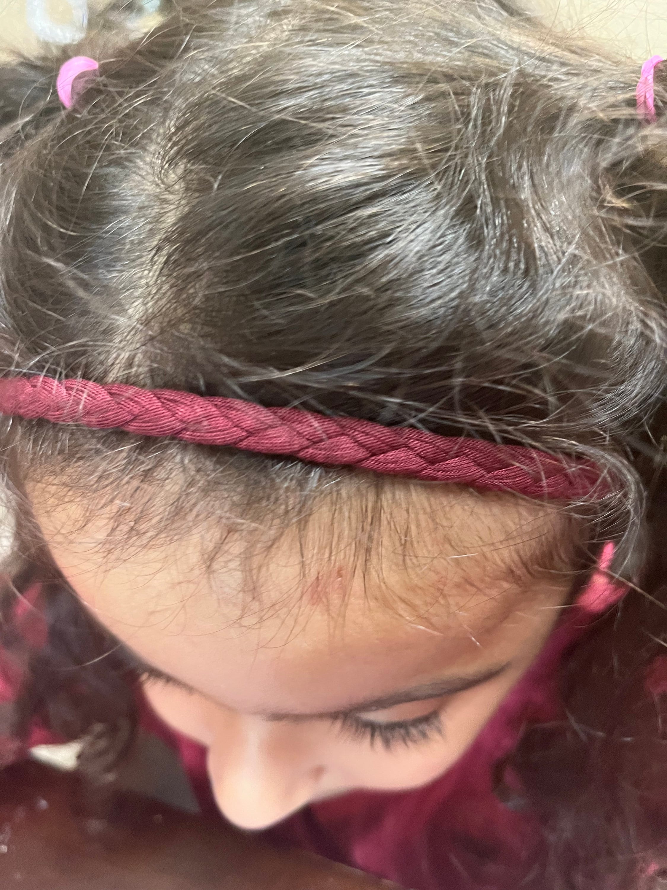 Cochlear Implant Headband - Etsy