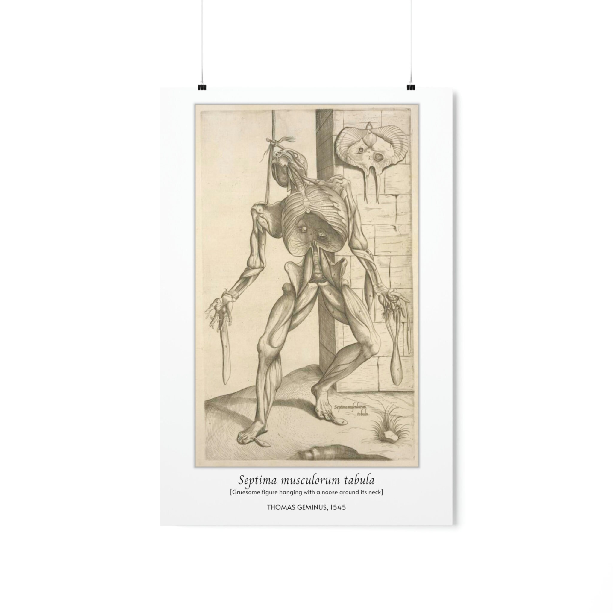 Gruesome Hanging Figure Poster | Vintage Human Anatomy Wall Decor ...