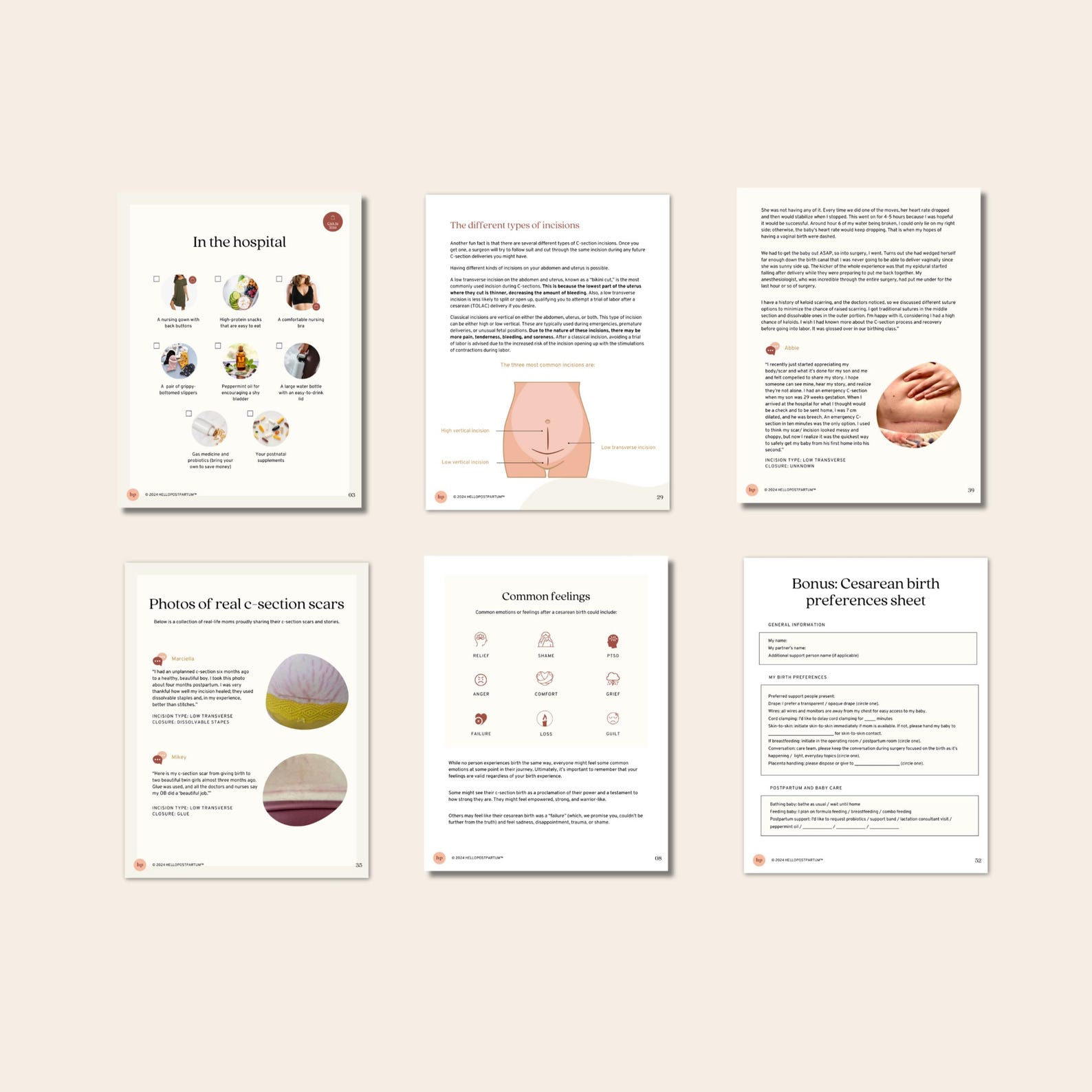 C-section Recovery Guide and Birth Plan Template Ebook Instant PDF ...