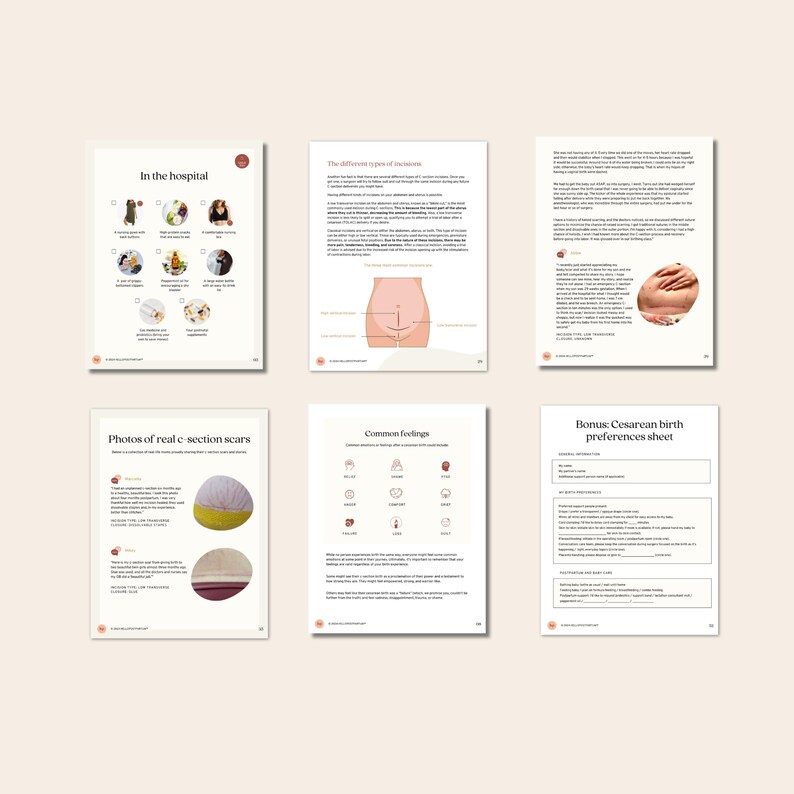 C-section Recovery Guide and Birth Plan Template Ebook Instant PDF ...