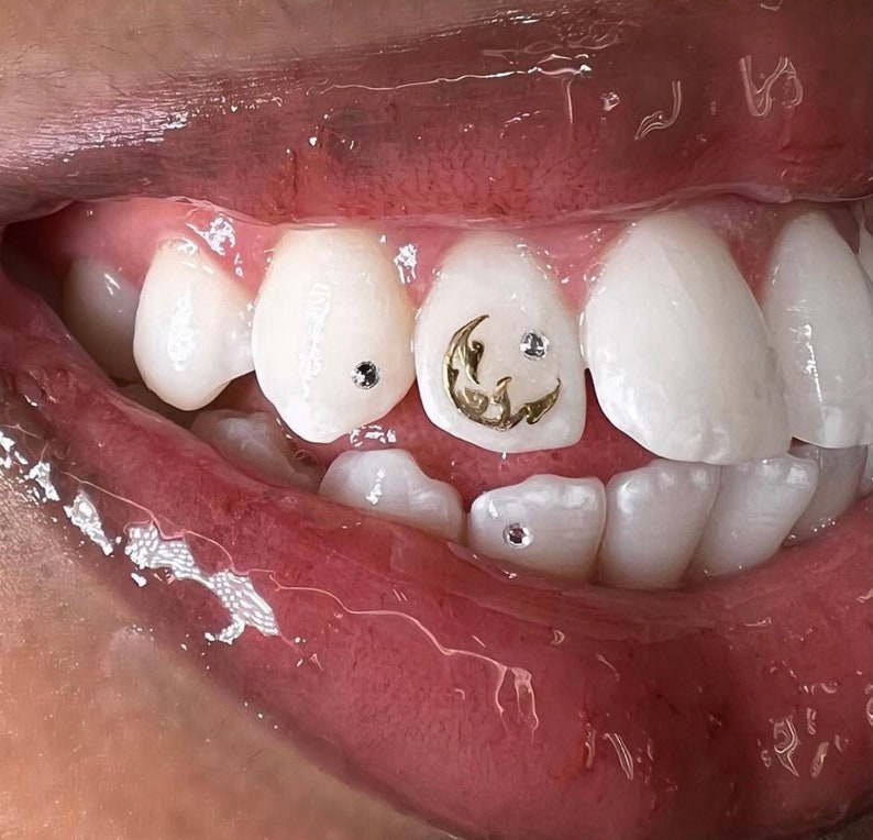 Tooth Gem Adhesive Etch Bonding Composite A2 LED LIGHT for Tooth Gem ...