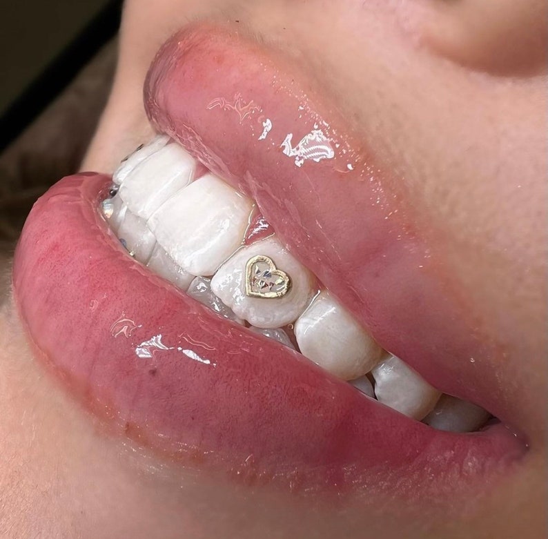 Tooth Gem Adhesive Etch Bonding Composite A2 LED LIGHT for Tooth Gem ...