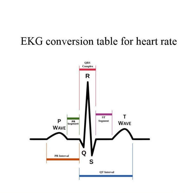 Quick EKG Conversion Table for HR - Etsy