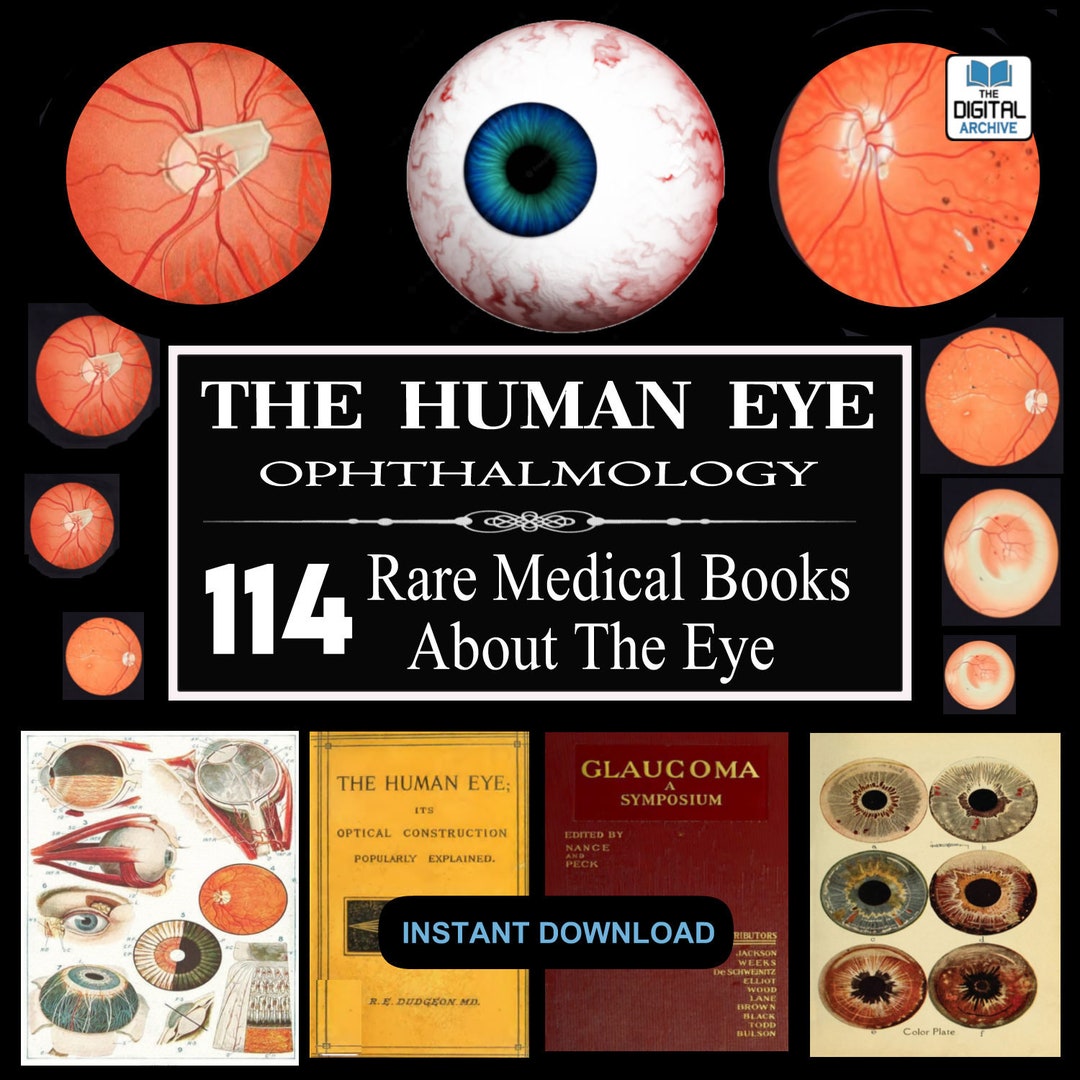 Human Eye, Rare Medical Books, Vision, Ophthalmology, Anatomy, Surgery ...