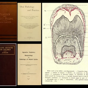104 DENTISTRY BOOKS, Teeth, Dentist, Dental Anatomy, Surgery, Medicine ...