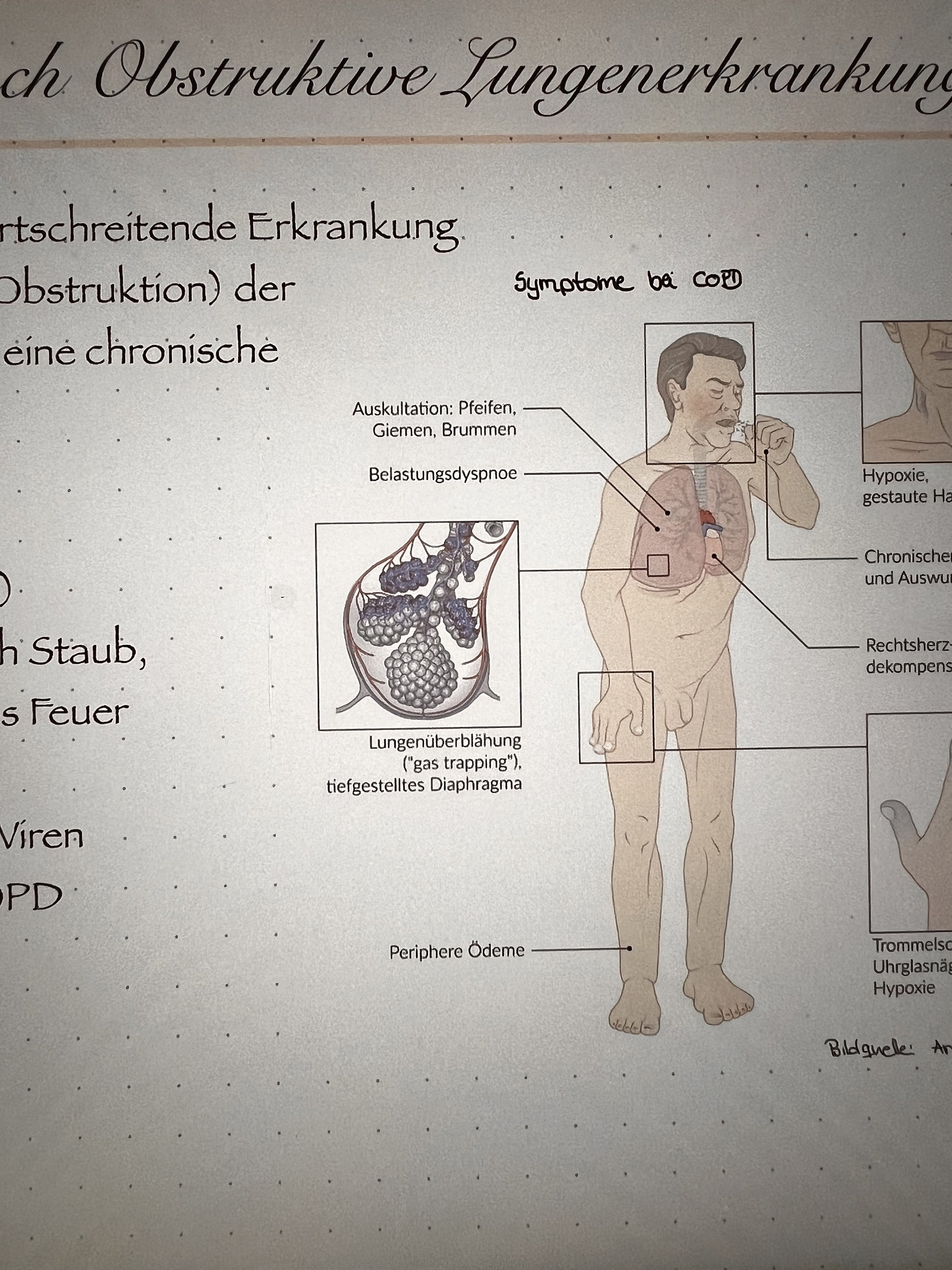 COPD Study Sheet - Etsy