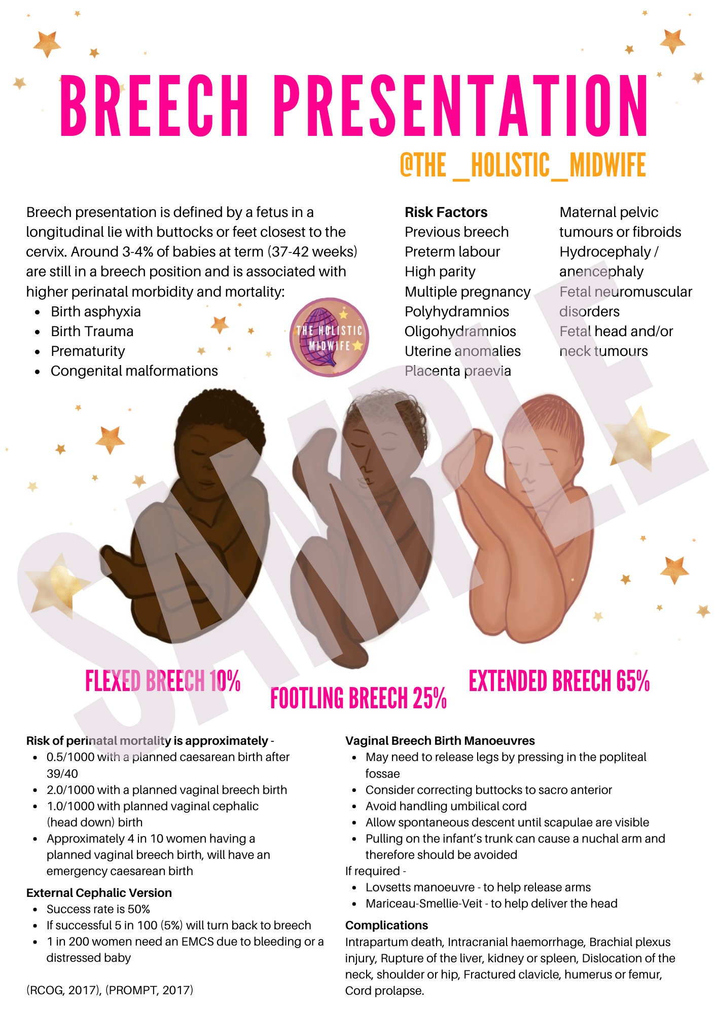 Breech Presentation Revision Poster - Etsy UK