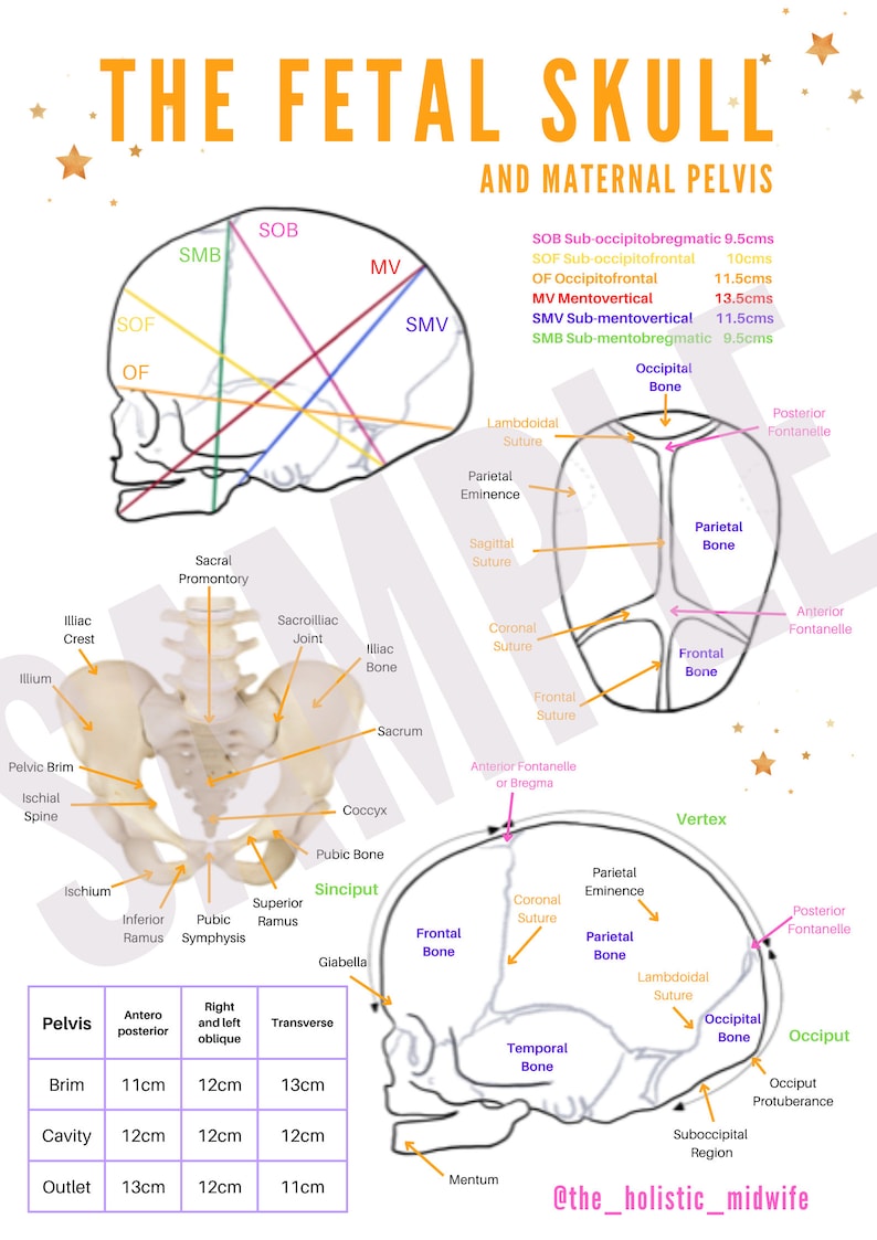 Fetal Skull and Maternal Pelvis Revision Poster - Etsy