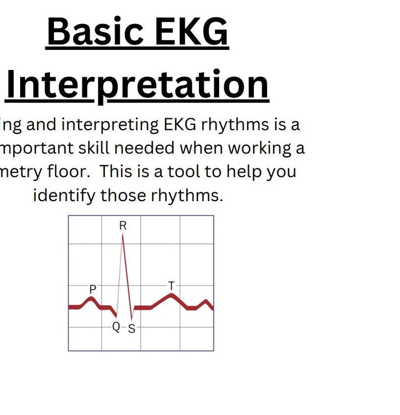Basic EKG Interpretation - Etsy