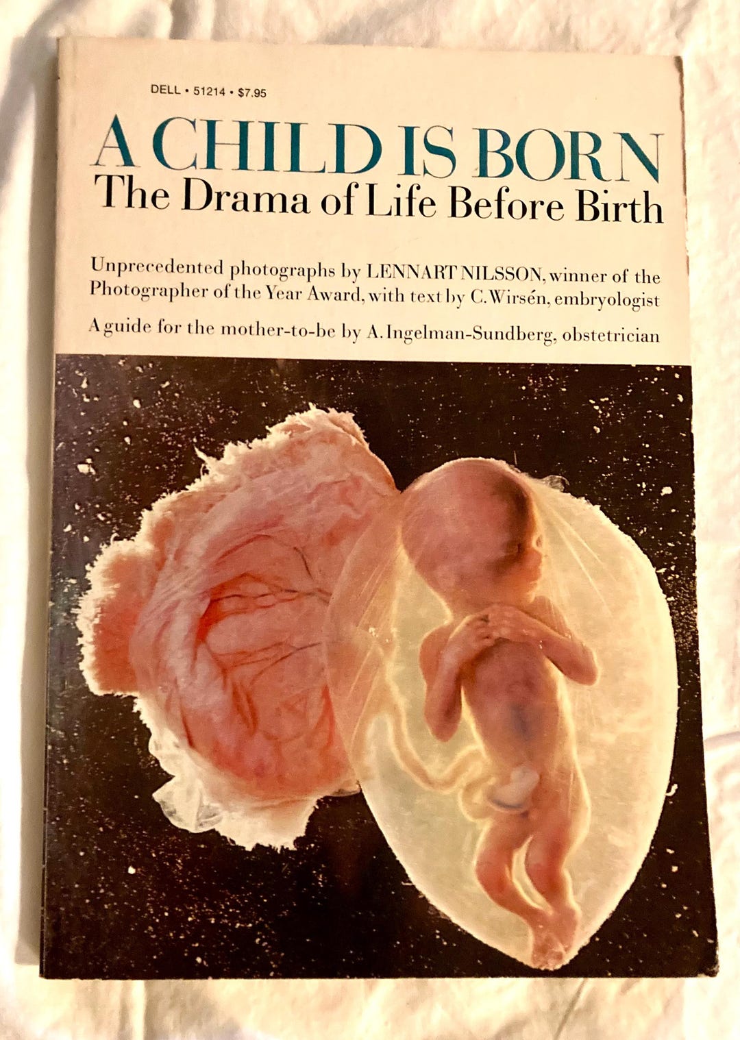 A Child is Born: the Drama of Life Before Birth, by Lennart Nilsson - Etsy