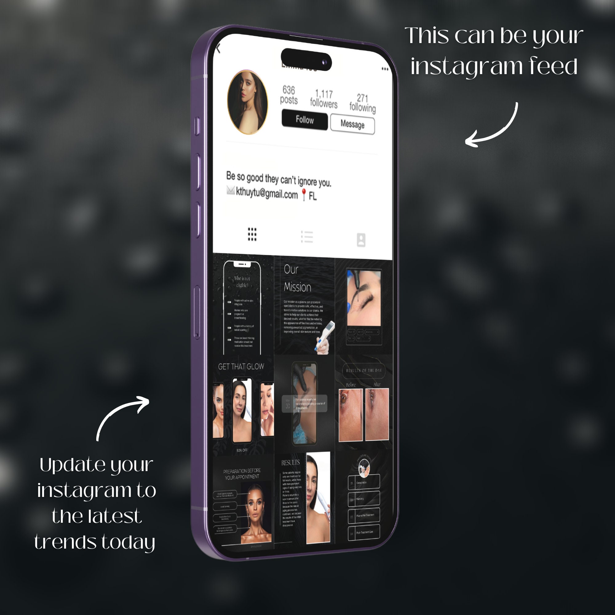 100 Plasma Pen Instagram Templates | Plasma Fibroblast Templates ...