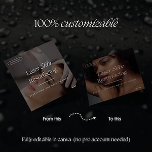 100 Laser Skin Resurfacing Instagram Templates | Esthetician Instagram ...