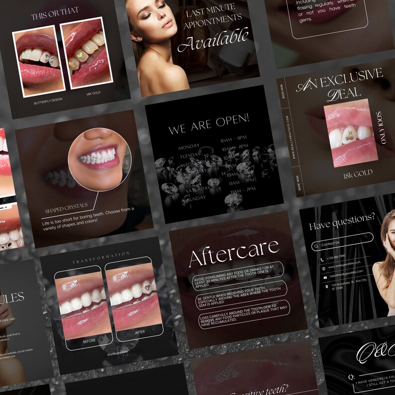 80 Tooth Gem Instagram Templates Tooth Jewelry Posts Tooth - Etsy