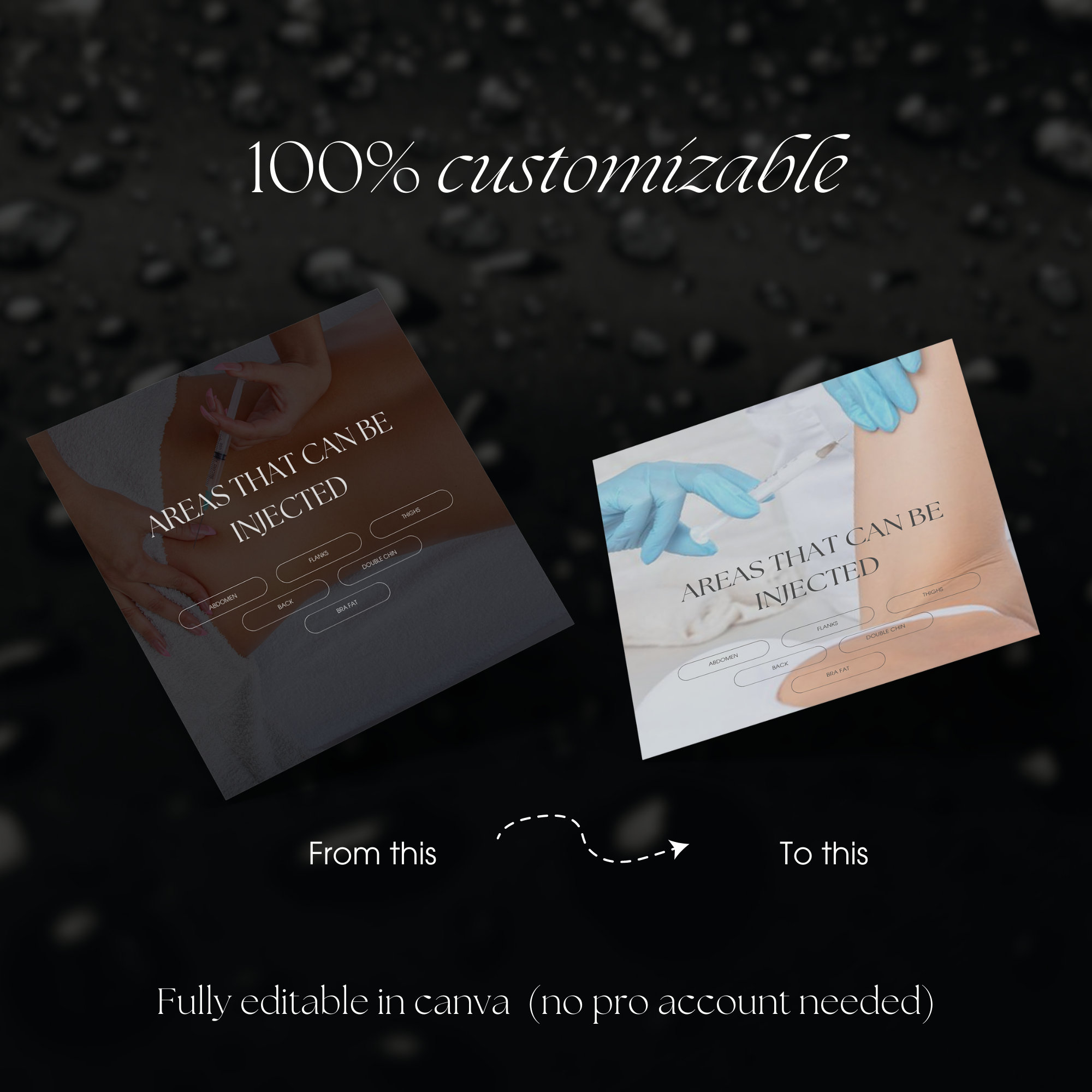 100 Injectable Lipolysis Instagram Templates | Lipolytic Injections ...