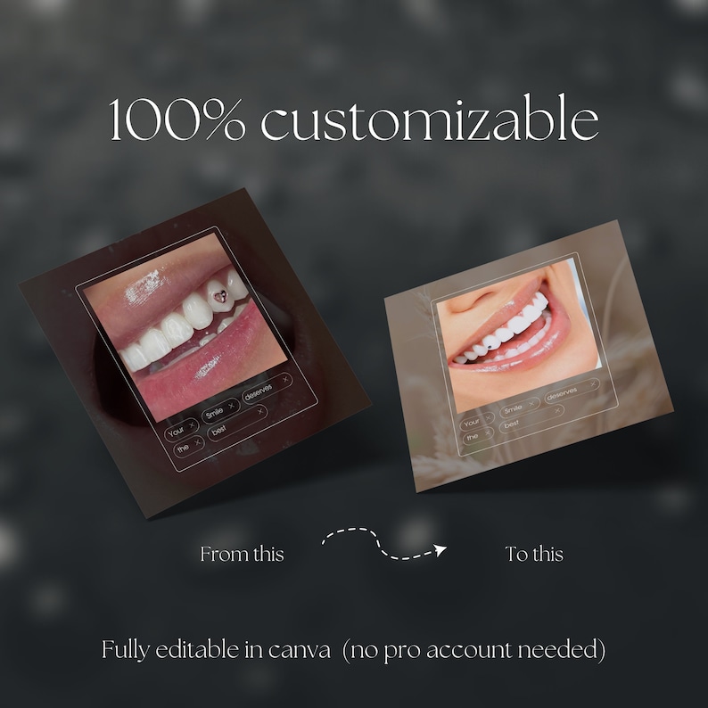 80 Tooth Gem Instagram Templates Tooth Jewelry Posts Tooth - Etsy