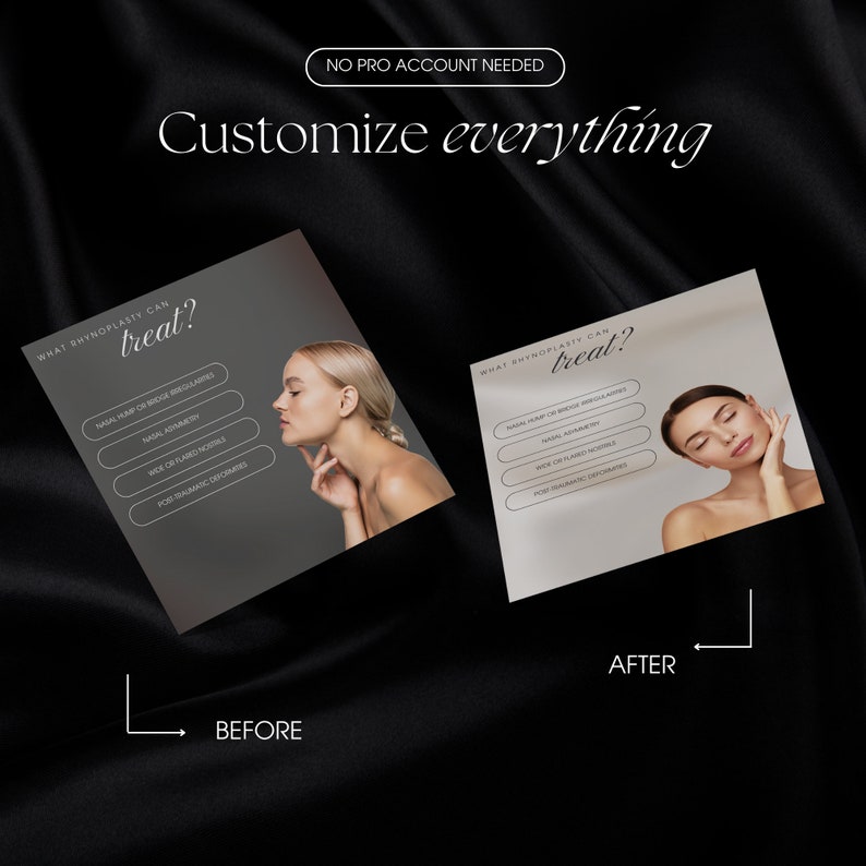 120 Plastic Surgery Instagram Templates | Cosmetic Surgery Instagram ...