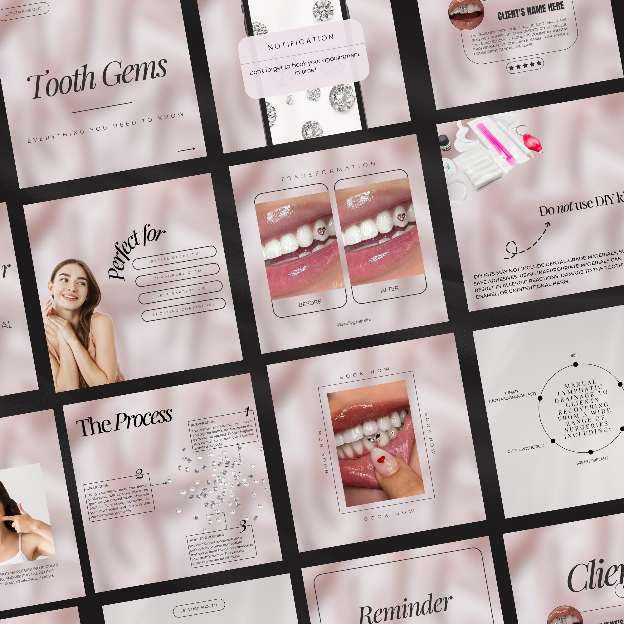 120 Pink Tooth Gem Instagram Templates Tooth Jewelry Posts Tooth Charms ...