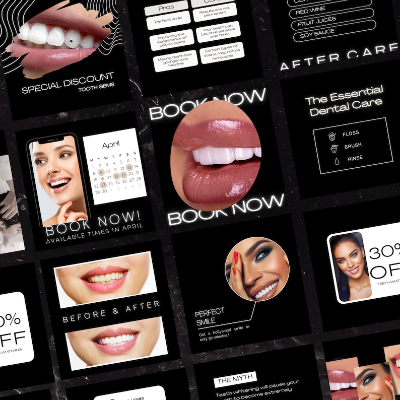 50 Teeth Whitening Instagram Templates Tooth Gem Instagram - Etsy