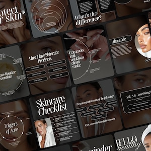 Skincare Instagram Templates | Esthetician Instagram Template ...