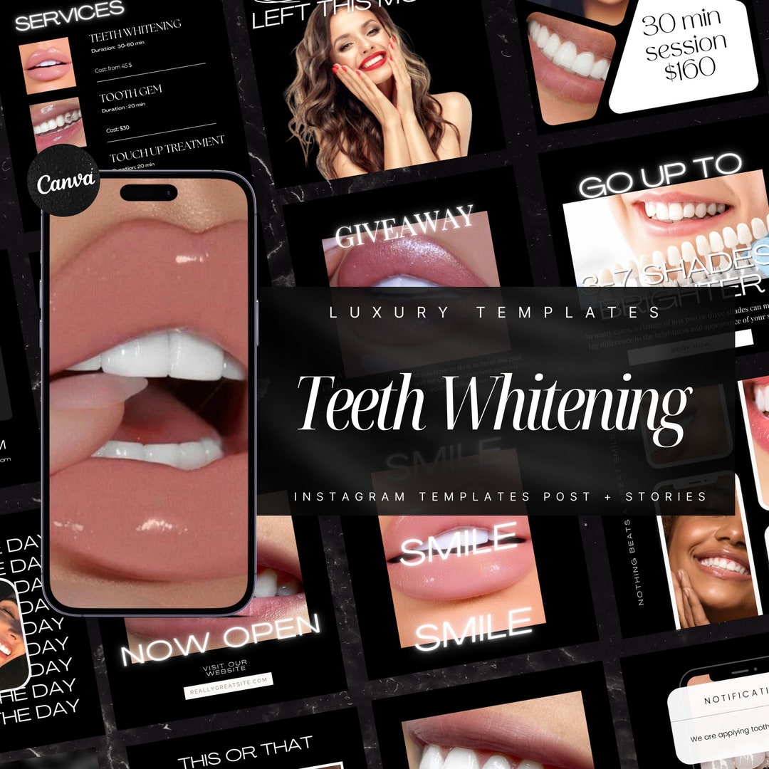 50 Teeth Whitening Instagram Templates | Tooth Gem Instagram Templates ...