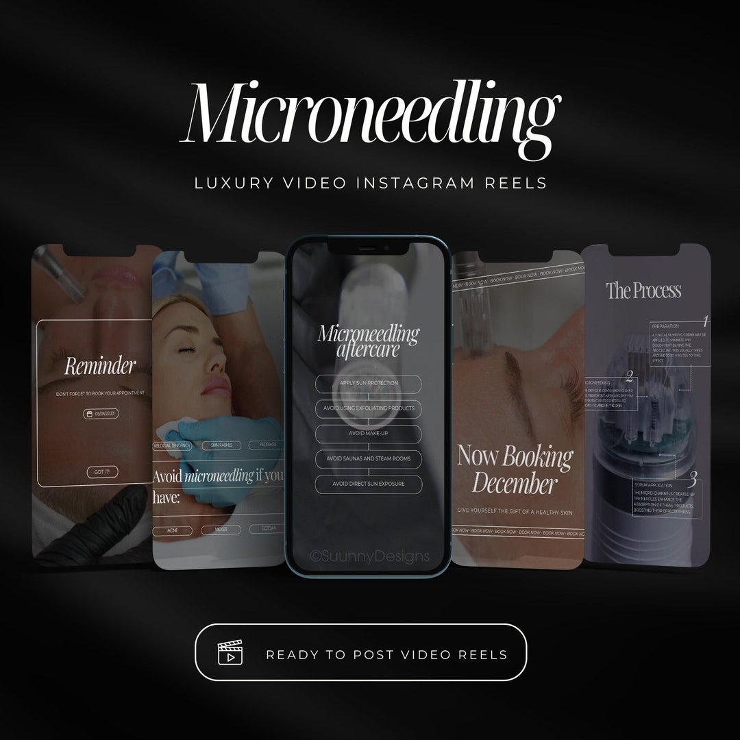 Microneedling Instagram Reels | Esthetician Instagram Template | Facial ...