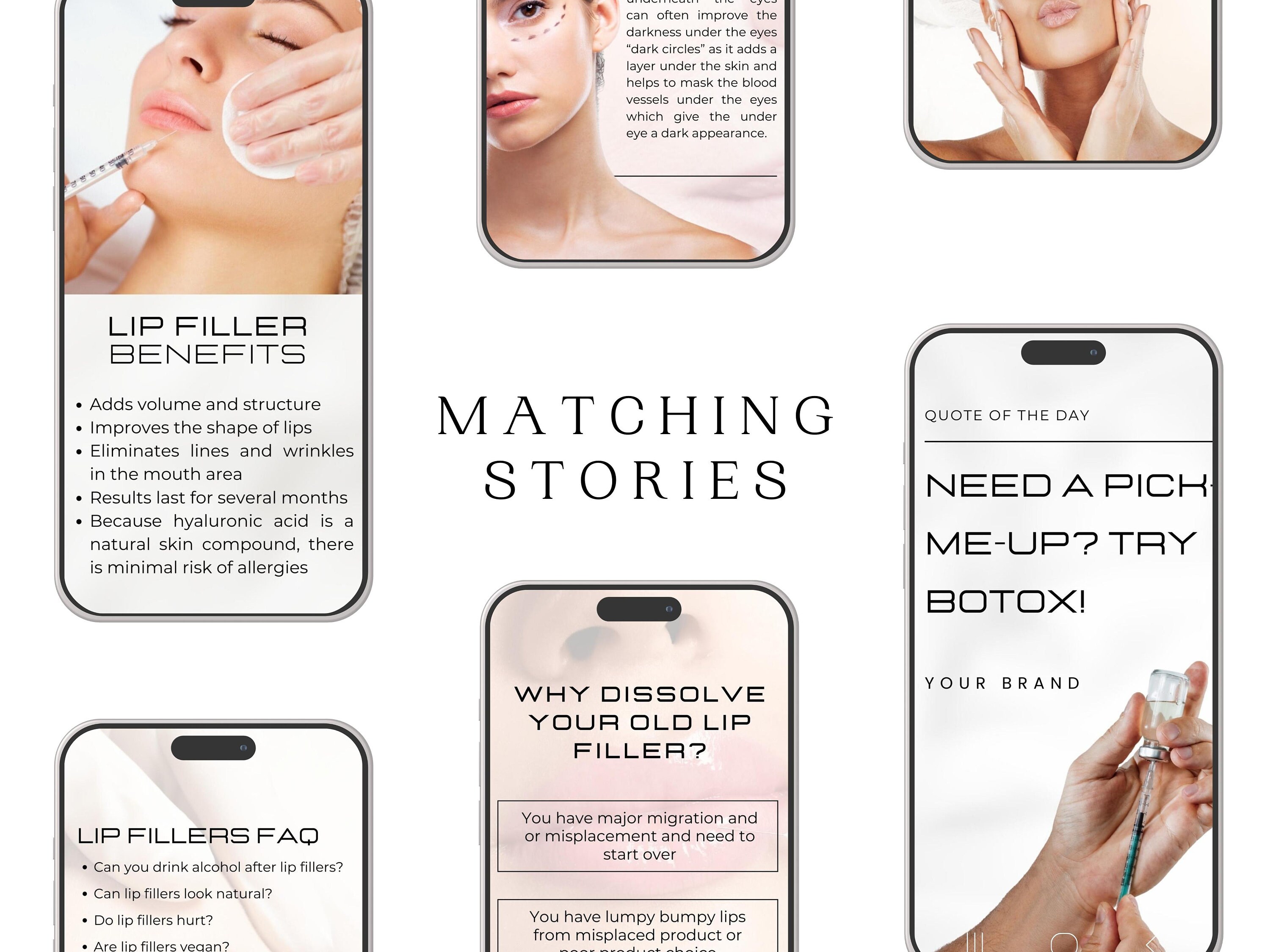 120 Botox and Filler Instagram Templates White Botox and Filler Posts ...