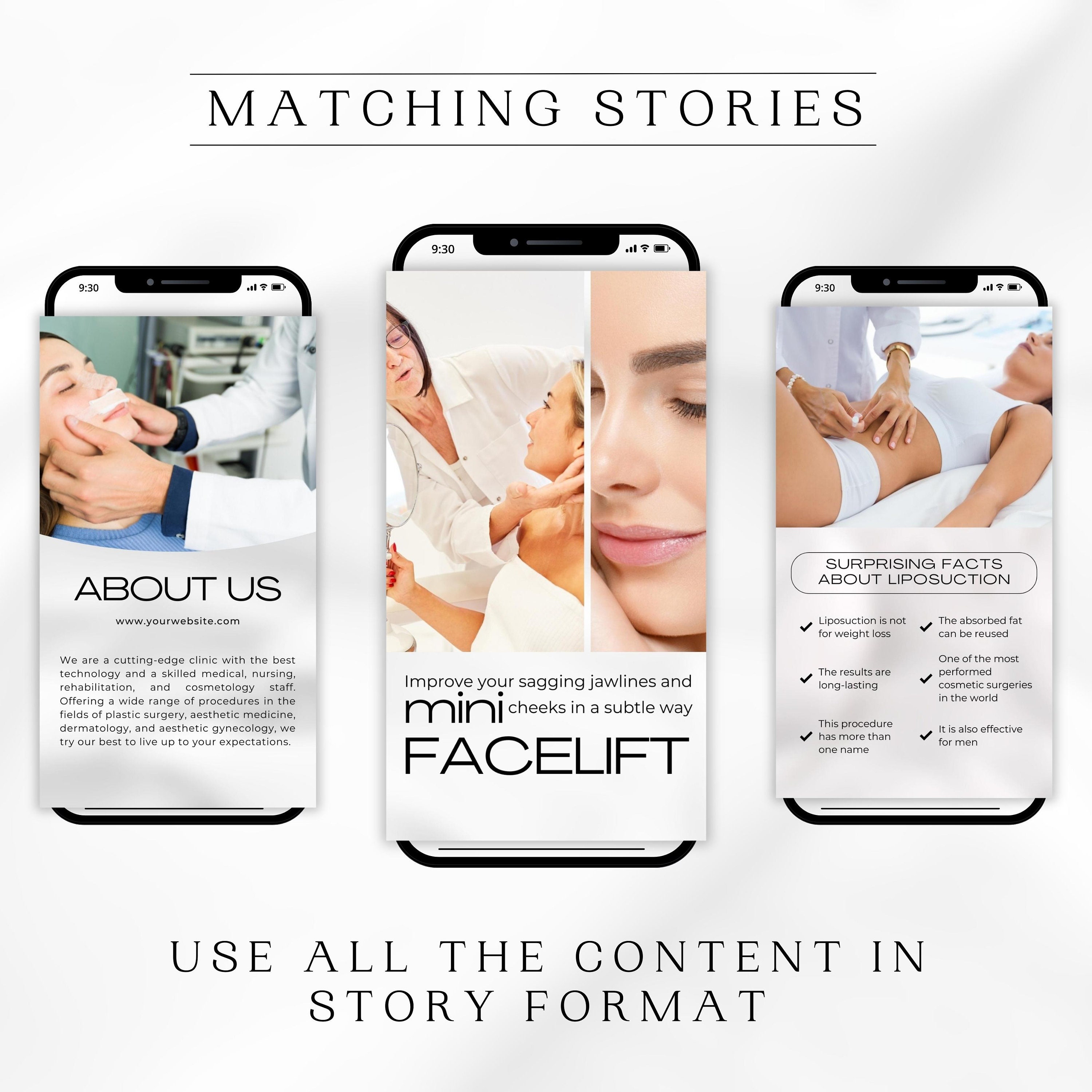 Plastic Surgery Instagram Templates: Rhinoplasty, Liposuction, & More ...