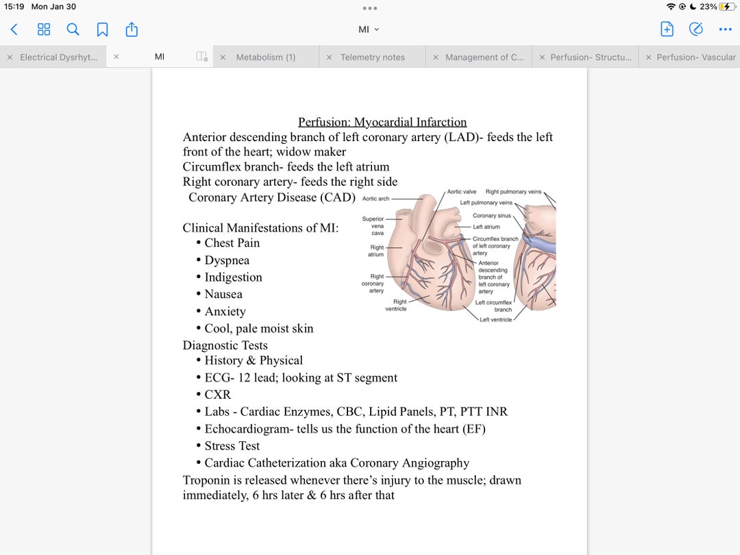 Myocardial Infarction Study Guide - Etsy