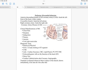 Acute Myocardial Infarction (MI) - STEMI Vs. NSTEMI - Compare ...