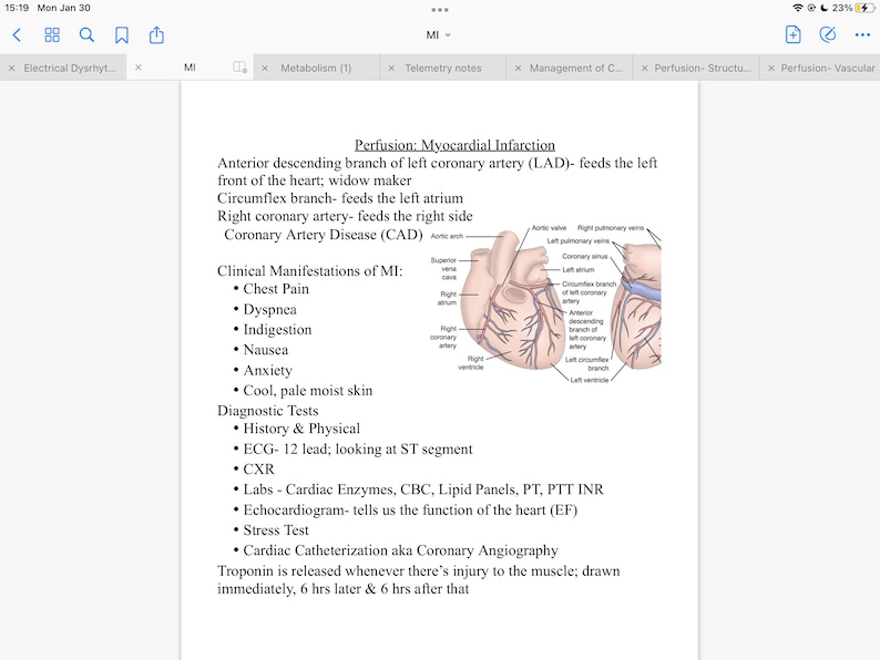 Myocardial Infarction Study Guide - Etsy