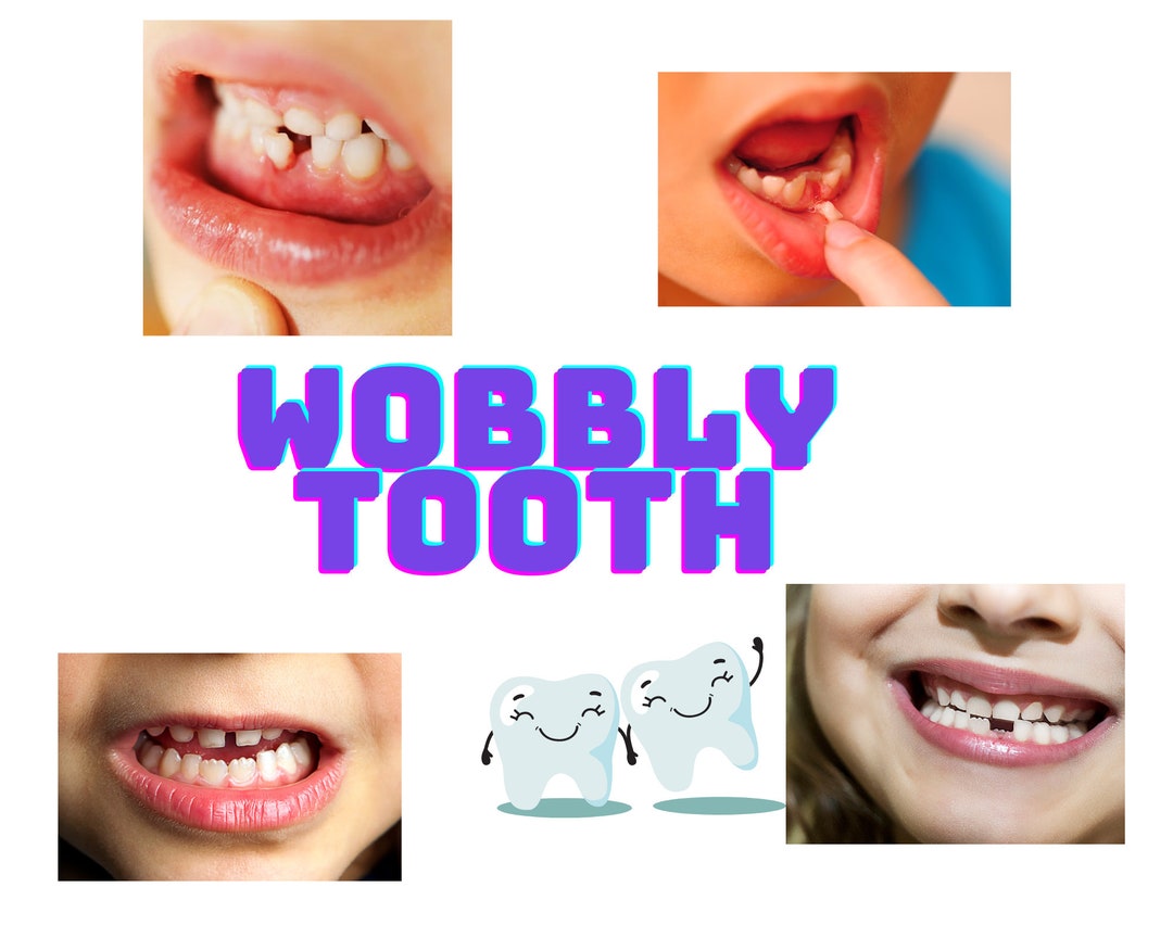 Wobbly Tooth, Autism Social Story for Anxious Child - Etsy