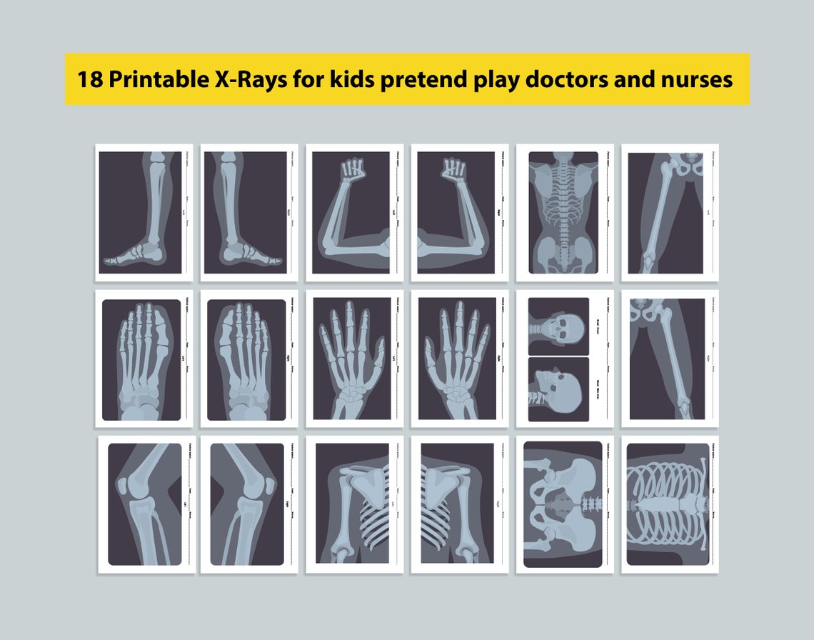 Druckbare Röntgenbilder für Kinder, Pretend Play Ärzte, Pretend Play ...
