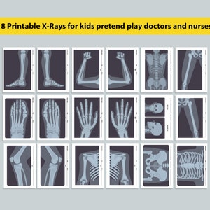 Printable X-ray Set for Kids Pretend Play (PDF Download A4/letter Size - Etsy