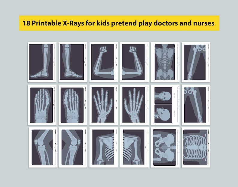 Printable X-rays for Kids, Pretend Play Doctors, Pretend Play Nurses, Hospital Pretend Play ...