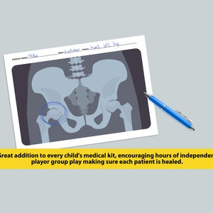 Printable X-ray Set for Kids Pretend Play (PDF Download A4/letter Size ...