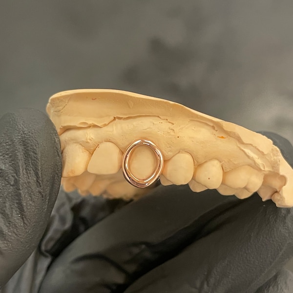 Gold Window Tooth - Etsy