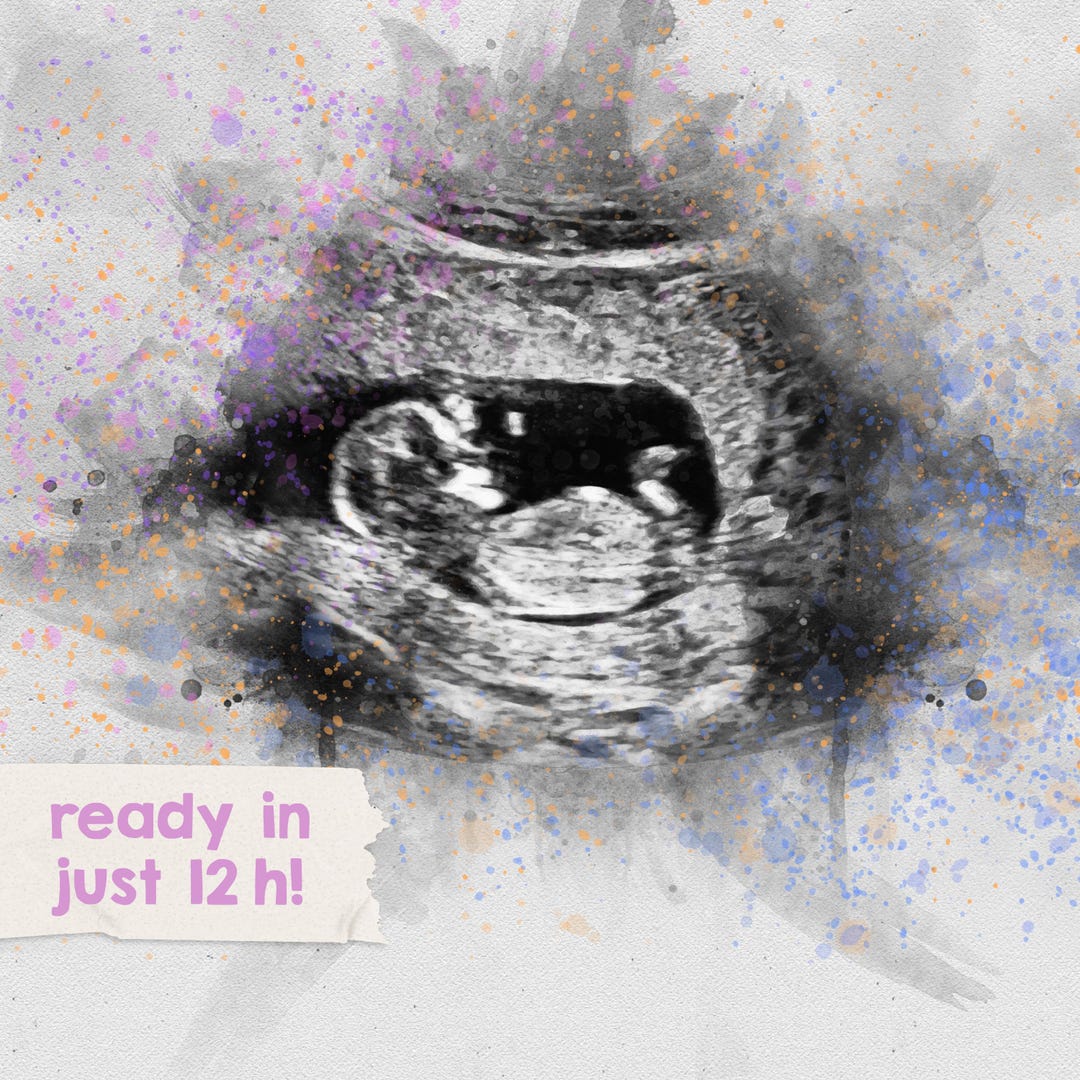 Baby Ultrasound Art Watercolor Sonogram Portrait Baby Shower Gift ...