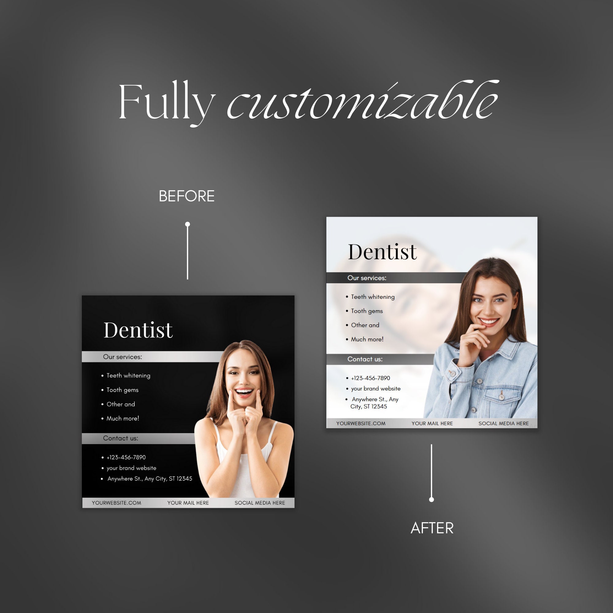 100 Teeth Whitening Instagram Templates Teeth Whitening Black Posts ...