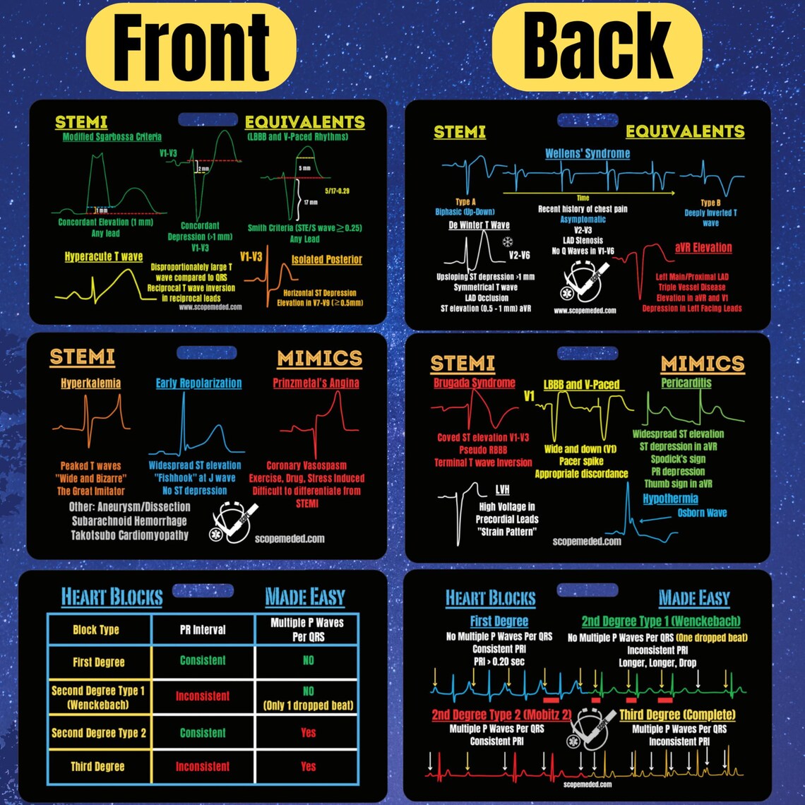 Scope EKG Badge Card – 3 Piece Double-sided STEMI Badge Card Set ...