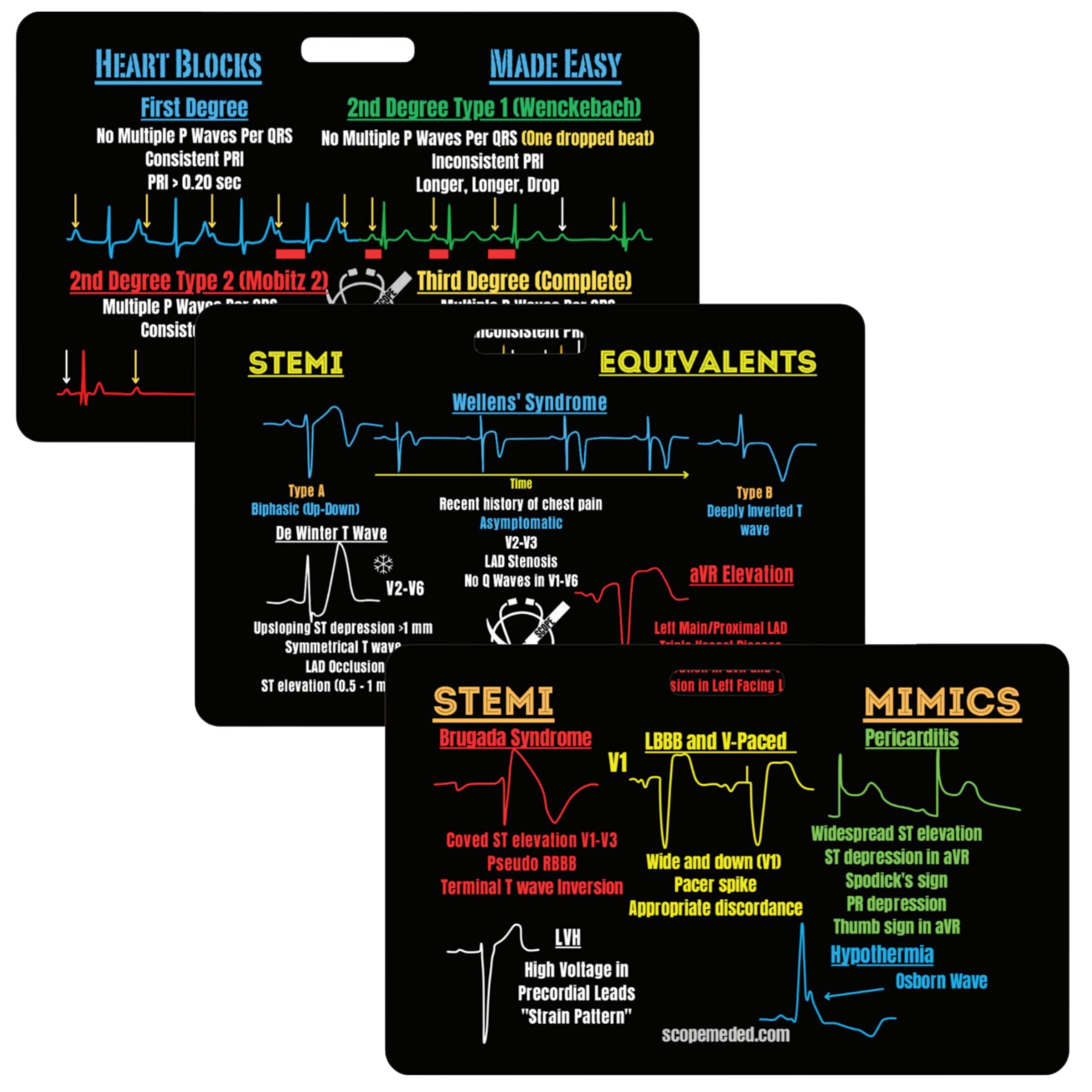 Scope EKG Badge Card – 3 Piece Double-sided STEMI Badge Card Set ...
