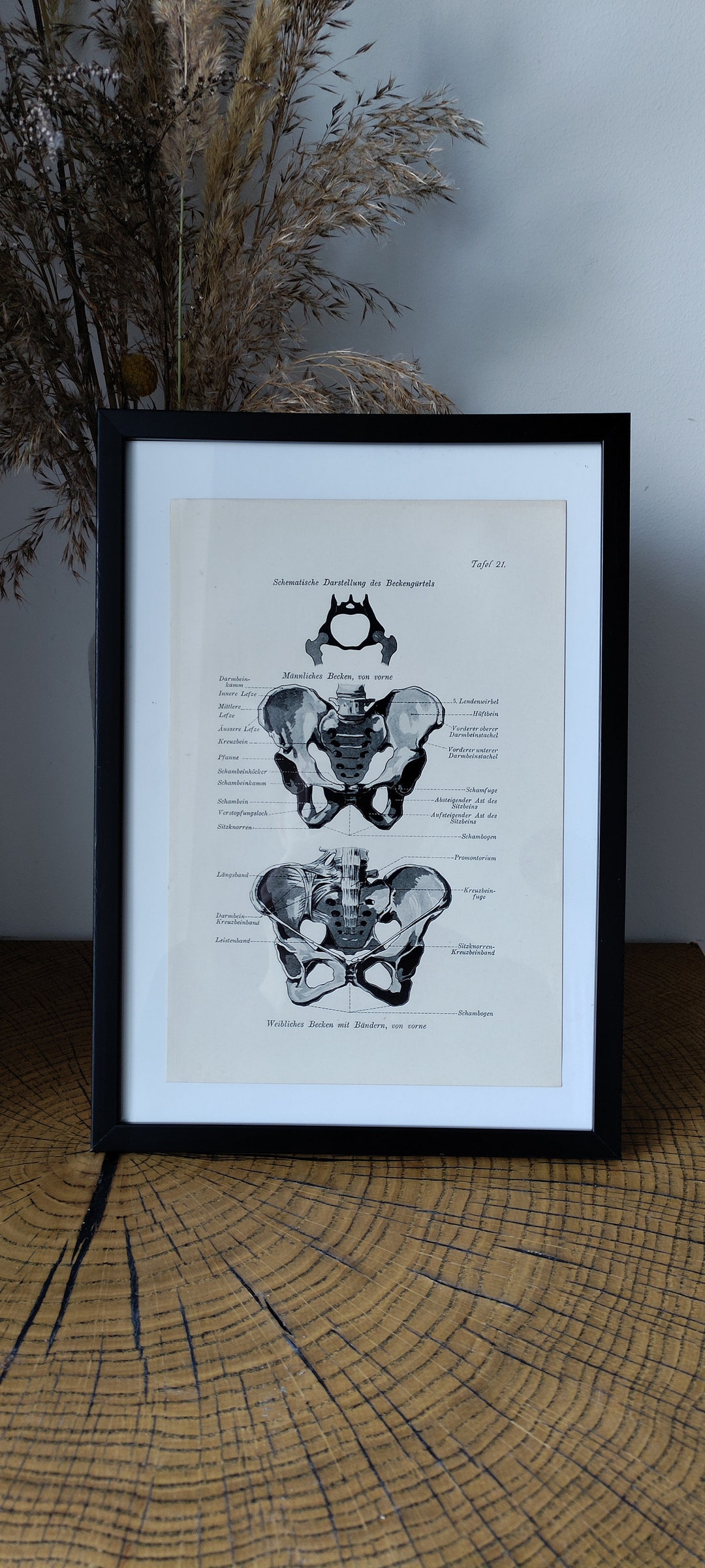 Male and Female Pelvis From the Front Original Print From 1913 - Etsy