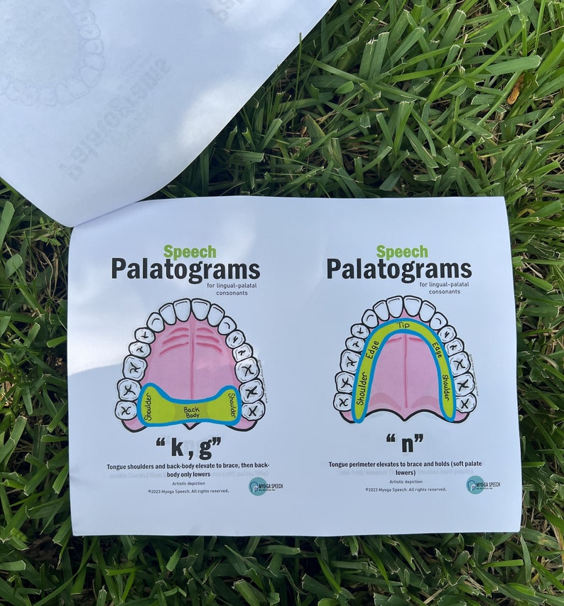 All SOUNDS Palatogram (13 Pages) of Tongue-palatal Consonants CHART ...