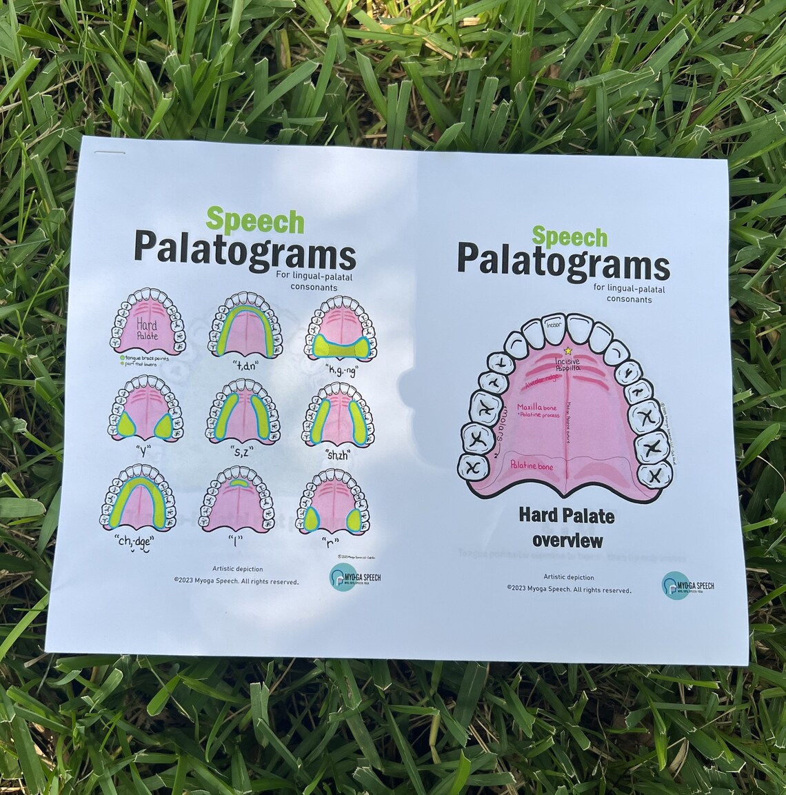 All SOUNDS Palatogram (13 Pages) of Tongue-palatal Consonants CHART ...