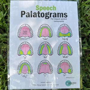 SOUNDS Palatogram (1 Page) of Tongue-palatal Consonants CHART (PDF ...