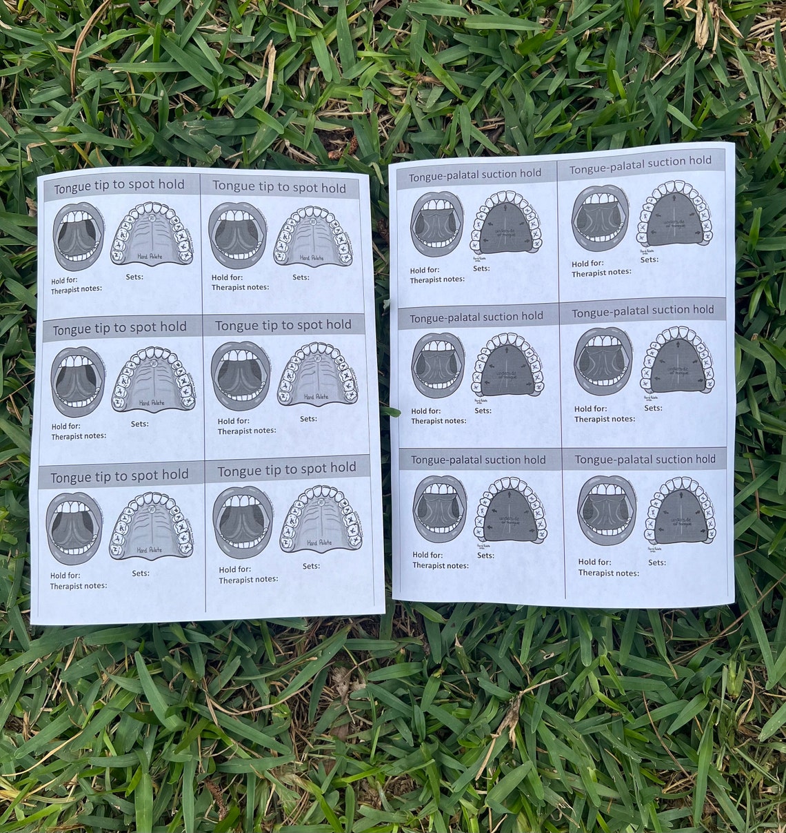 Tongue Myofunctional Therapy Exercise Cards Pdfs FREE Coloring Page ...