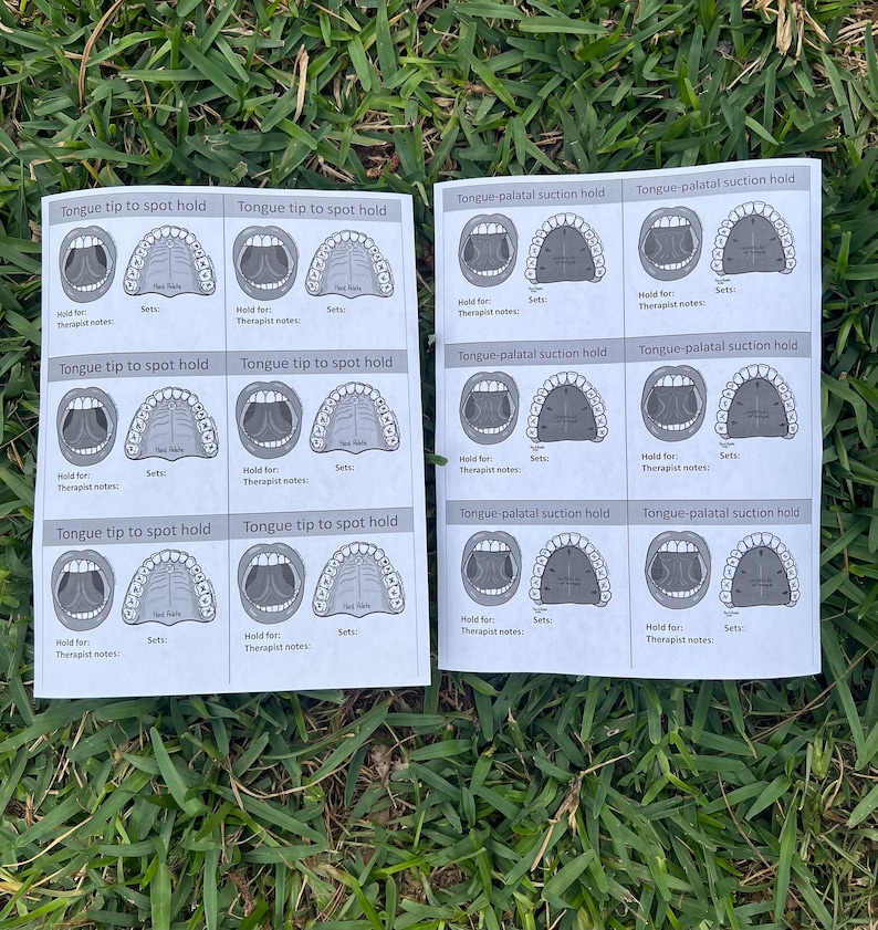 Tongue Myofunctional Therapy Exercise Cards Pdfs FREE Coloring Page ...