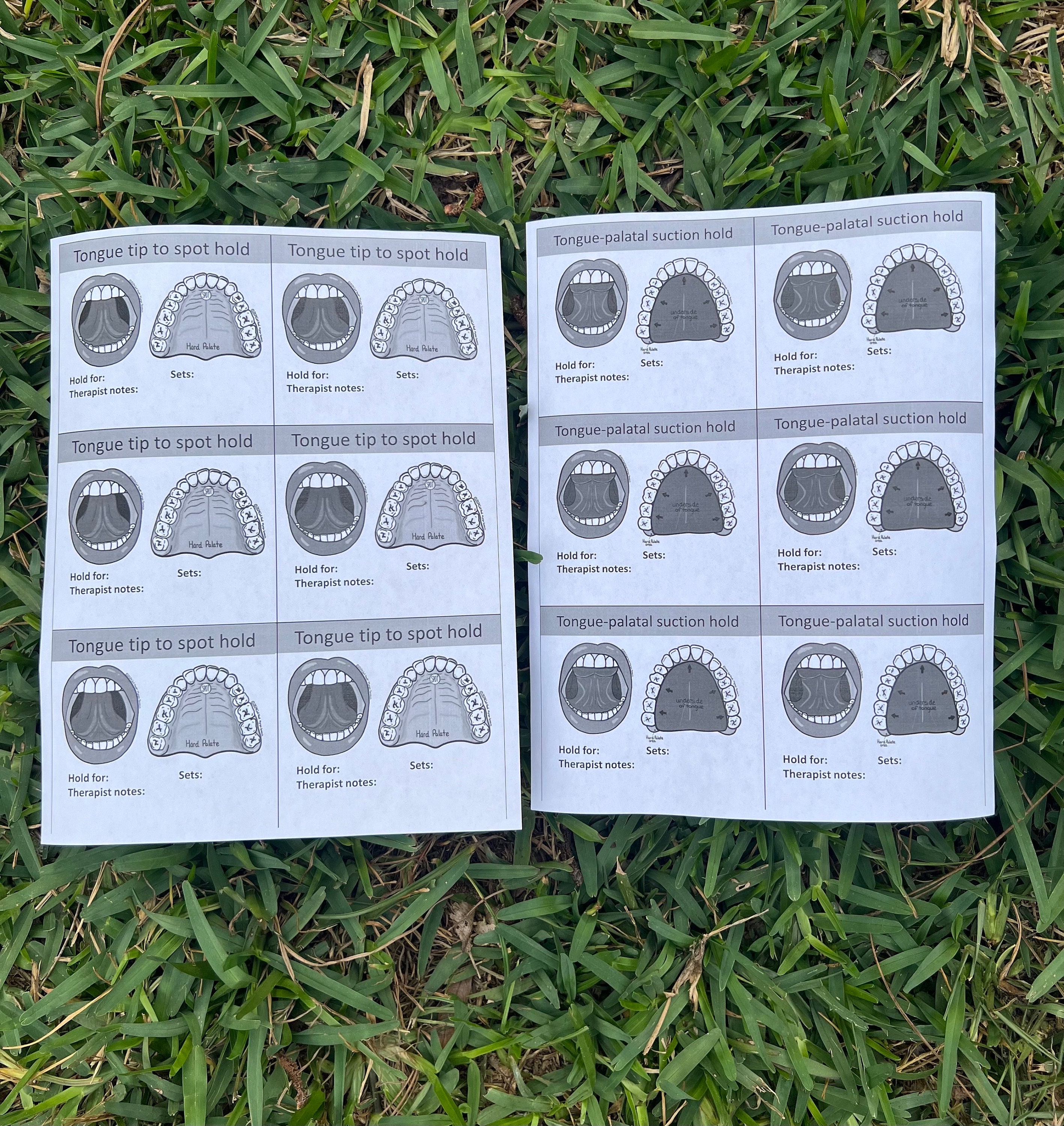 Tongue Myofunctional Therapy Exercise Cards Pdfs FREE Coloring Page ...